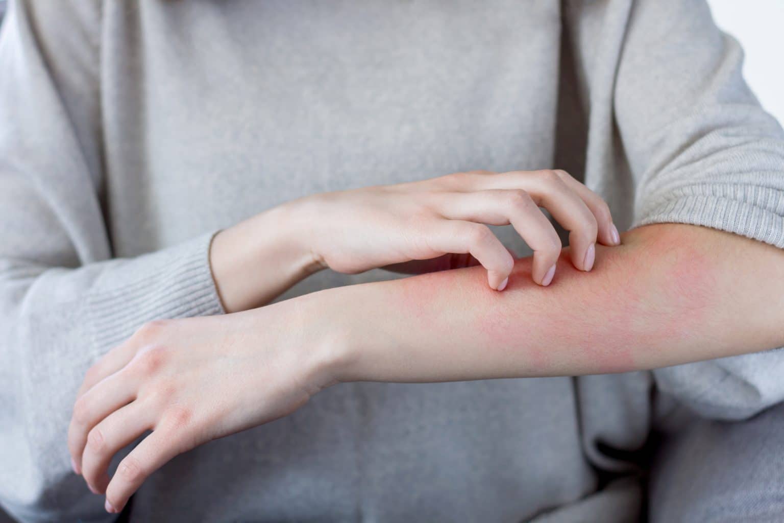 Is Your Rash from Hay Fever? | Carolina Pines ENT | Blog